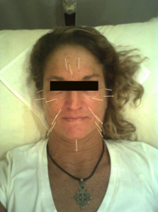 5 Elements Natural Medicine in Langkawi, Malaysia